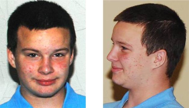 Federal Way police report sighting of missing autistic teen | UPDATE ...