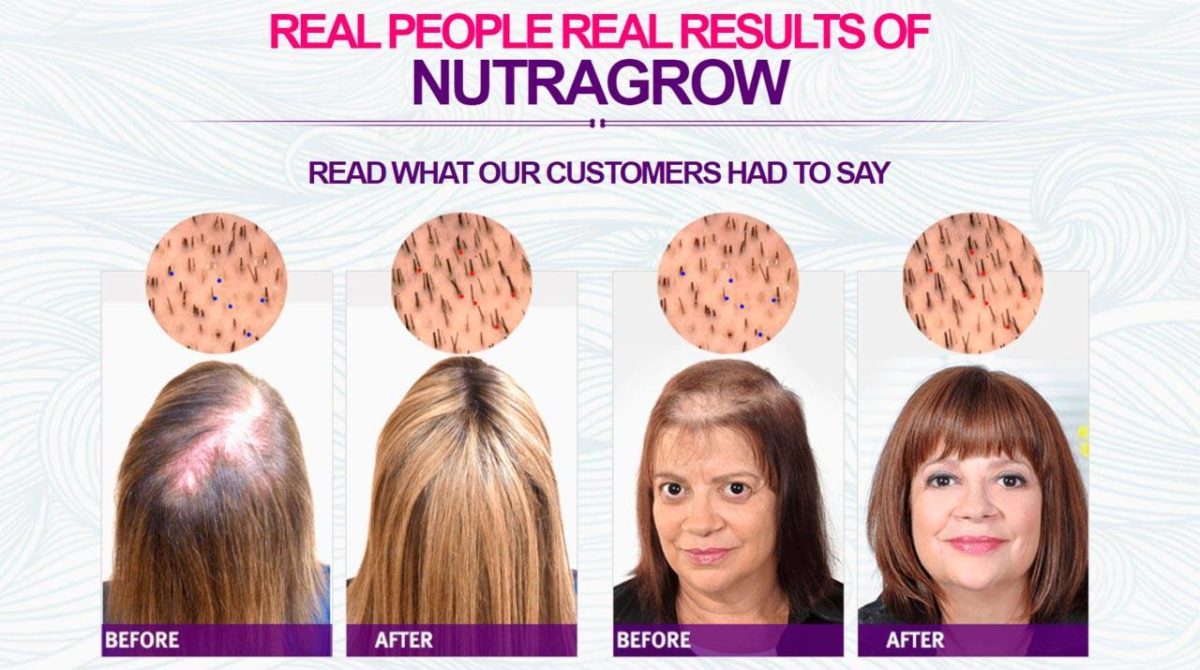 Nutragrow Review: Is Nutra Grow Biotin Hair Supplement Legit | Federal ...