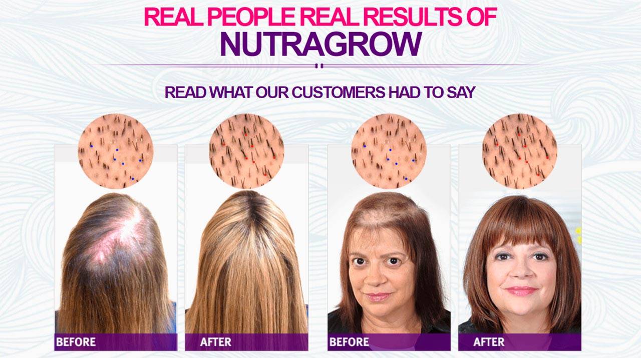 Nutragrow Review: Is Nutra Grow Biotin Hair Supplement Legit | Federal ...